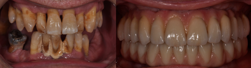 David Furze – A winner once again at the Aesthetic Dentistry Awards ...